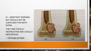 general principle of bone tumour | PPTX
