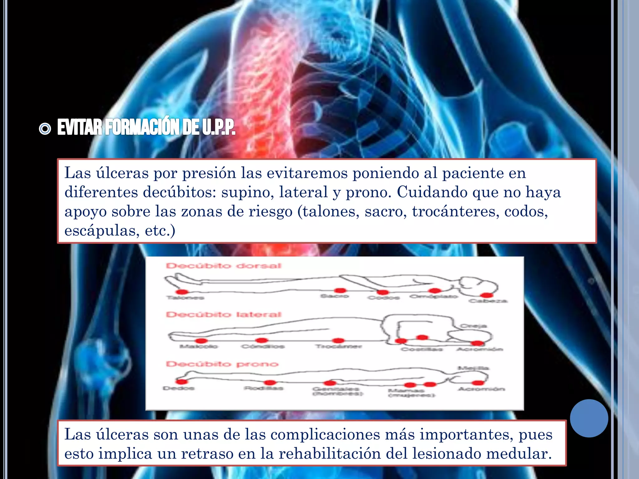 Lesión medular | PDF
