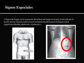 Lesionologia | PPTX