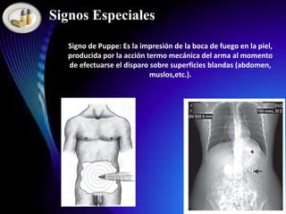 Lesionologia | PPTX