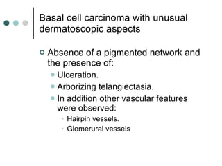 Basal cell carcinoma with unusual dermatoscopic aspects. | PPT
