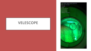 Lesion Presentation | PPT