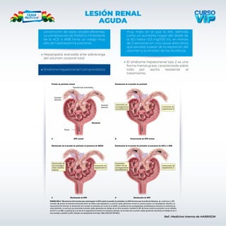 LESION RENAL AGUDA. resumen de harrison med int. | PDF
