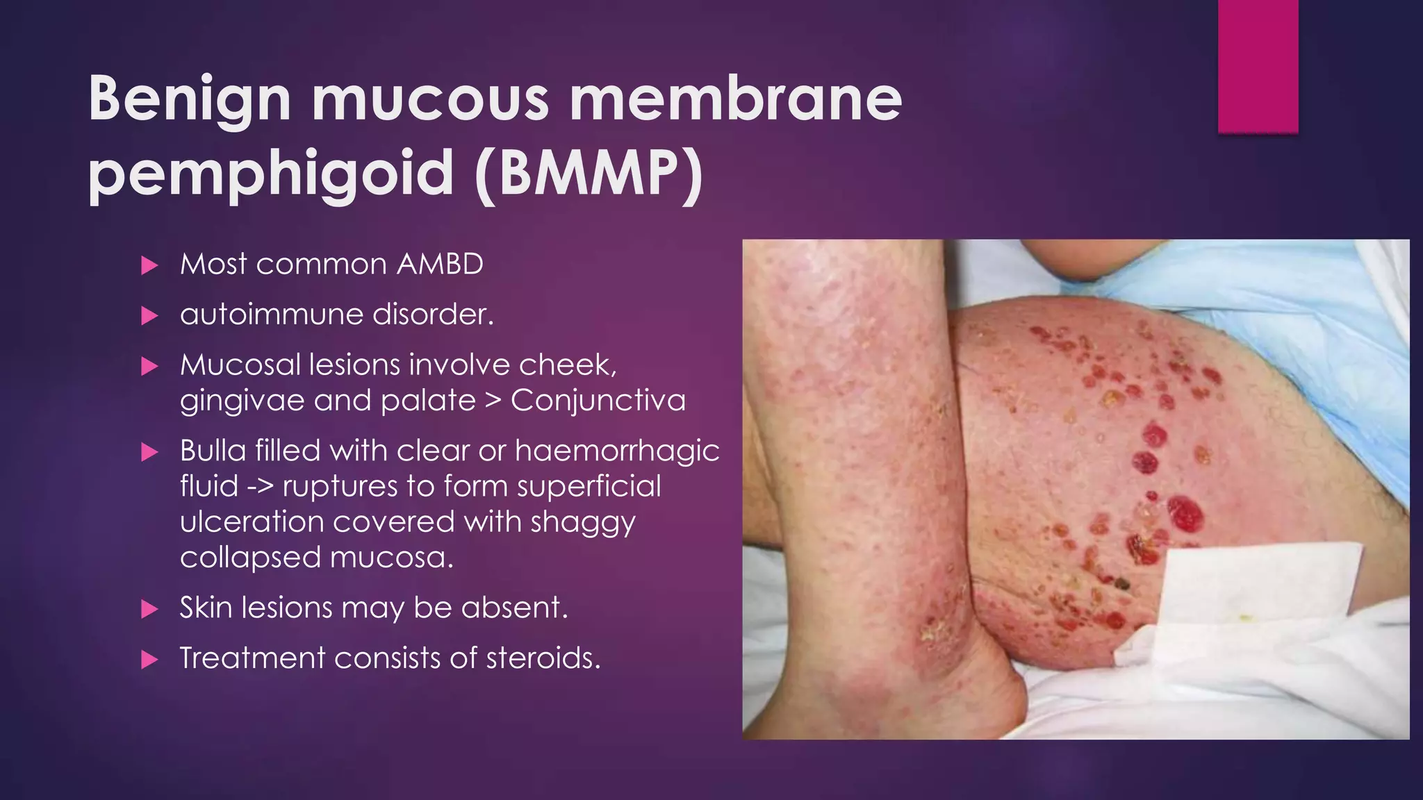 Lesions of oral cavity | PPTX