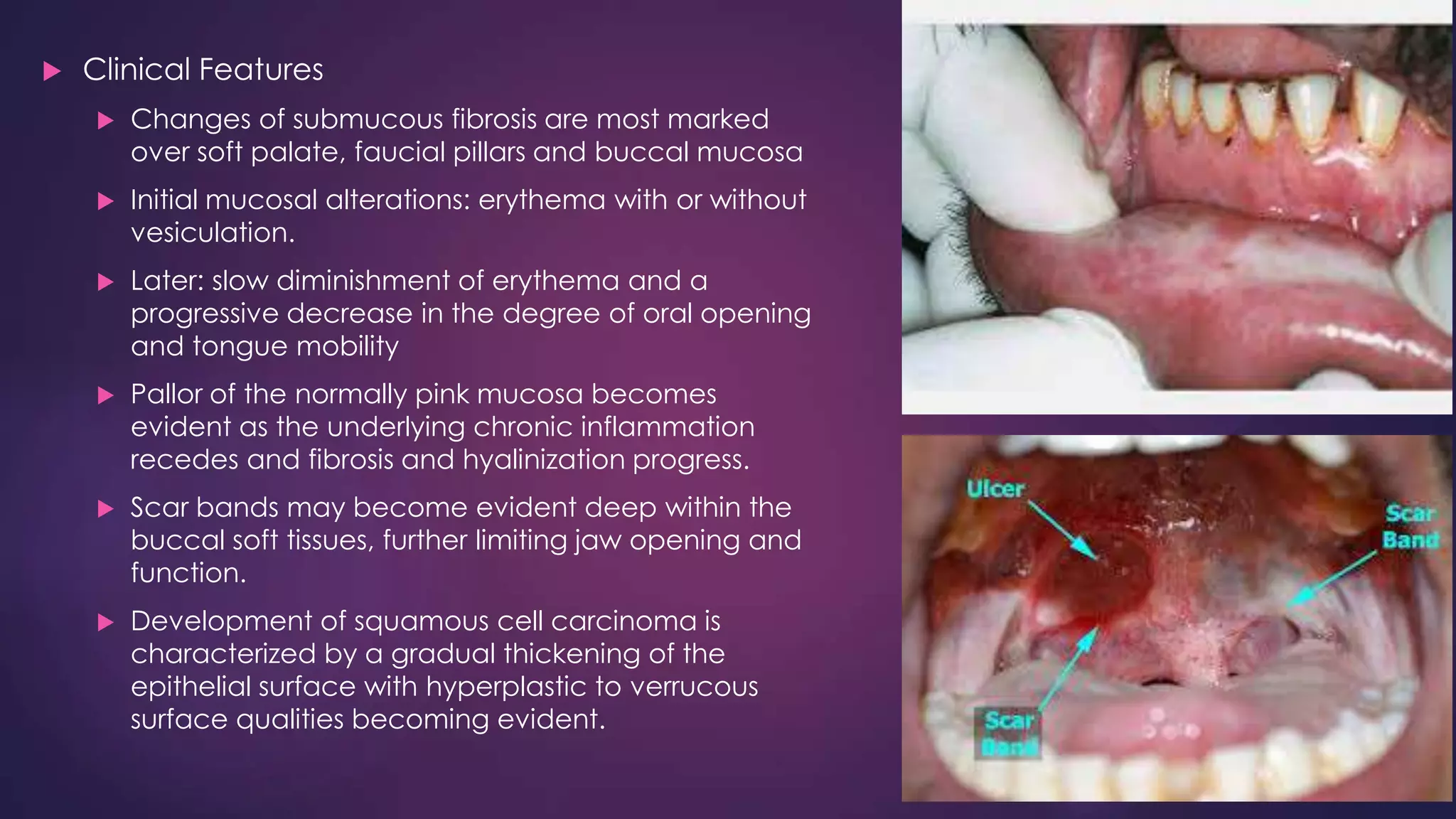 Lesions of oral cavity | PPTX