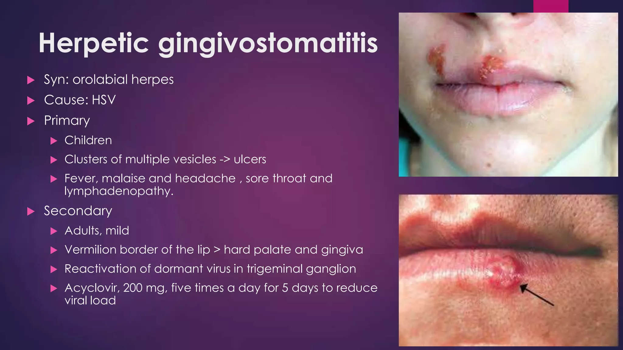 Lesions of oral cavity | PPTX