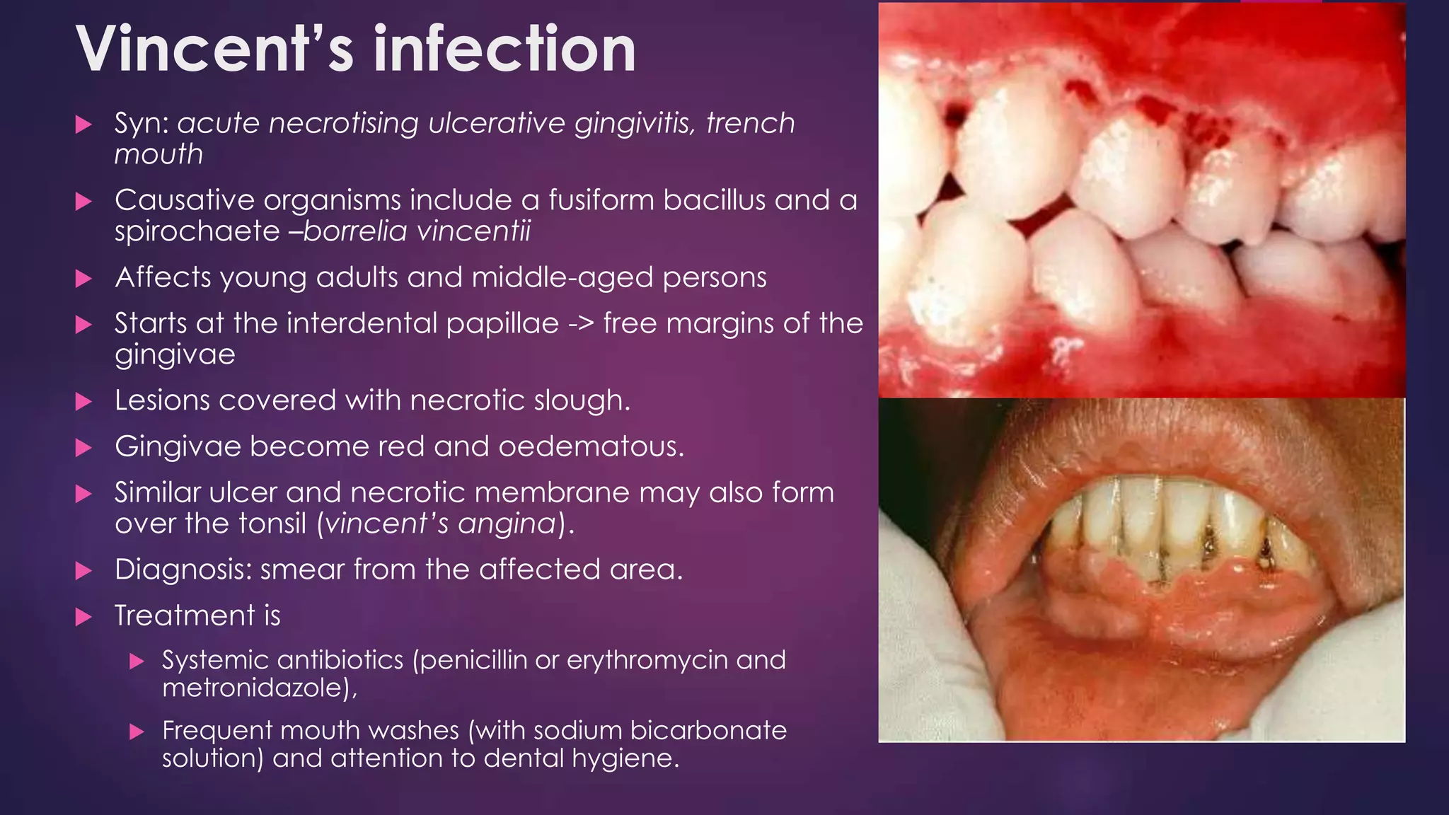 Lesions of oral cavity | PPTX