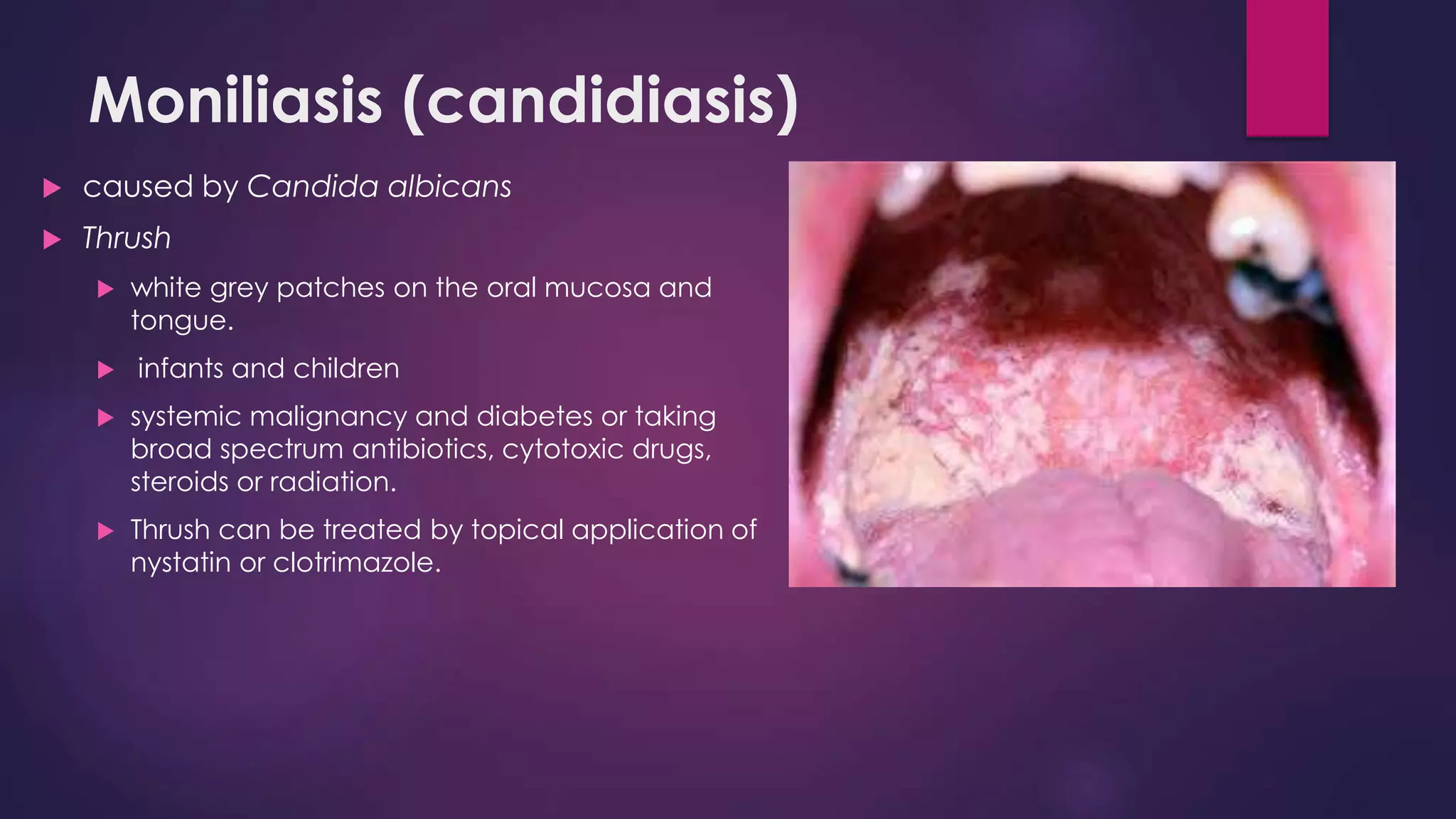 Lesions of oral cavity | PPTX