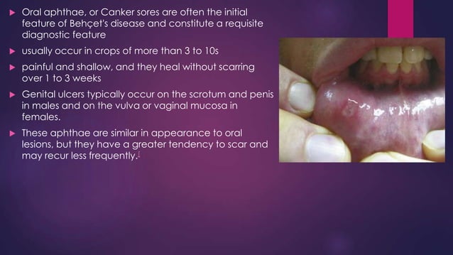 Lesions of oral cavity | PPTX | Dental Health | Diseases and Conditions