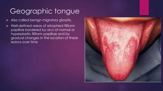 Lesions of oral cavity | PPTX