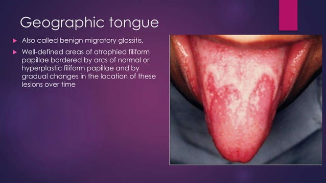 Lesions of oral cavity | PPTX | Dental Health | Diseases and Conditions
