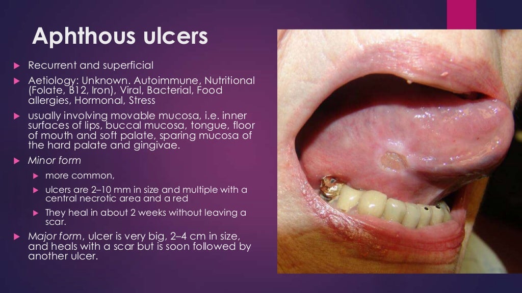 lesions-of-oral-cavity