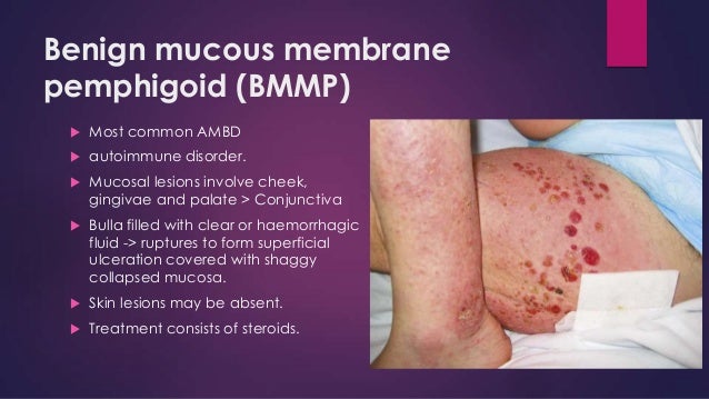 Lesions of oral cavity