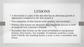 LESIONS.pptx