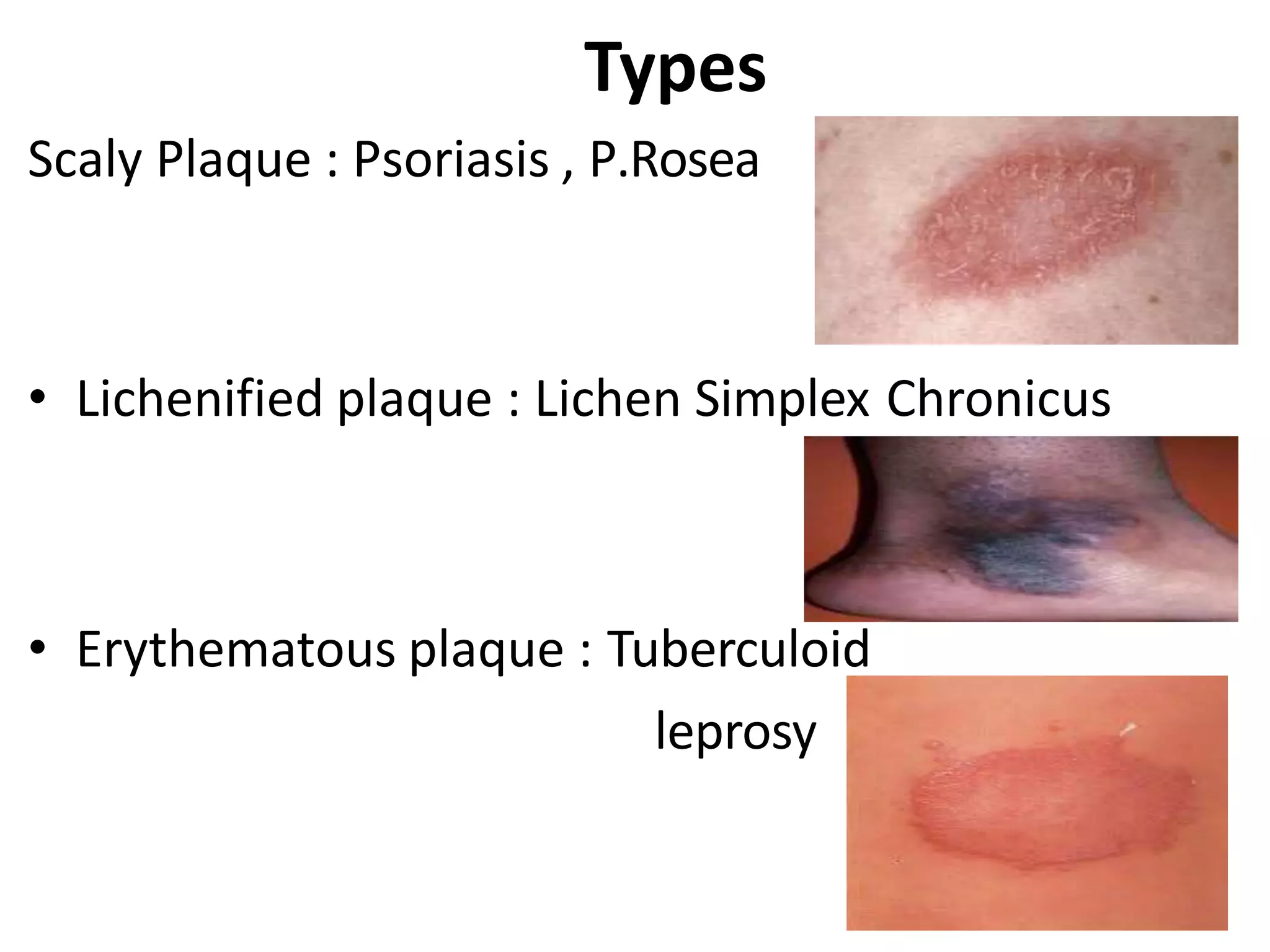 Lesions and abrasions in skin | PDF