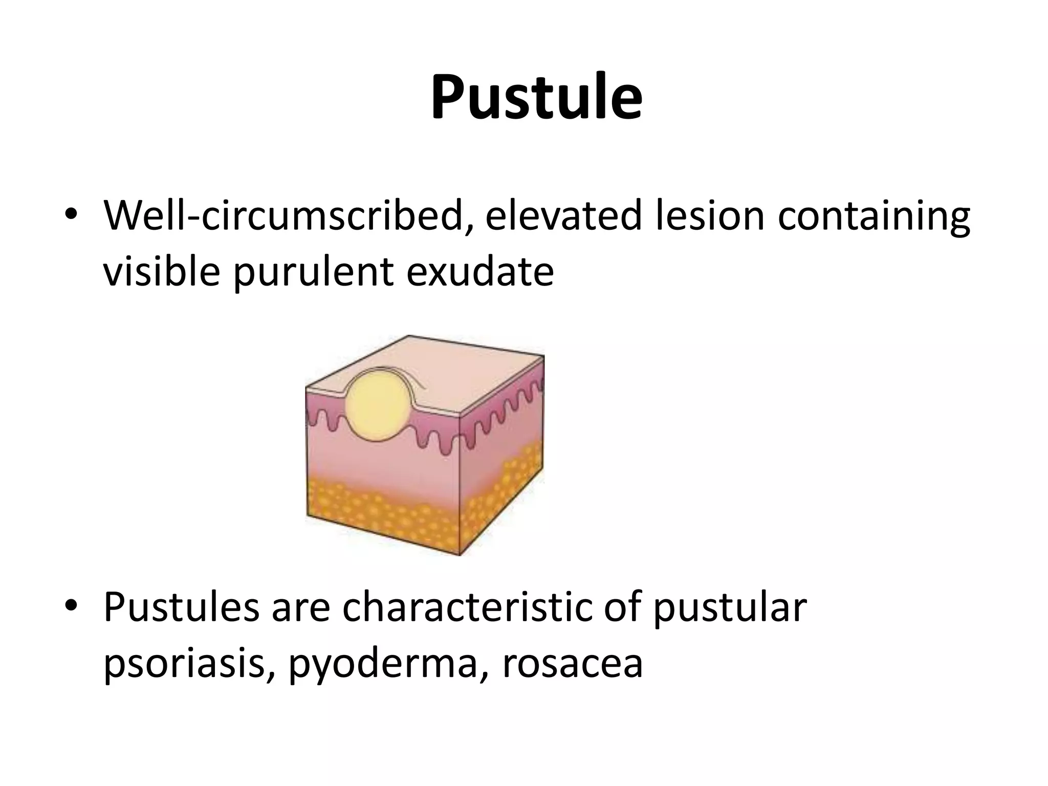 Lesions and abrasions in skin | PDF