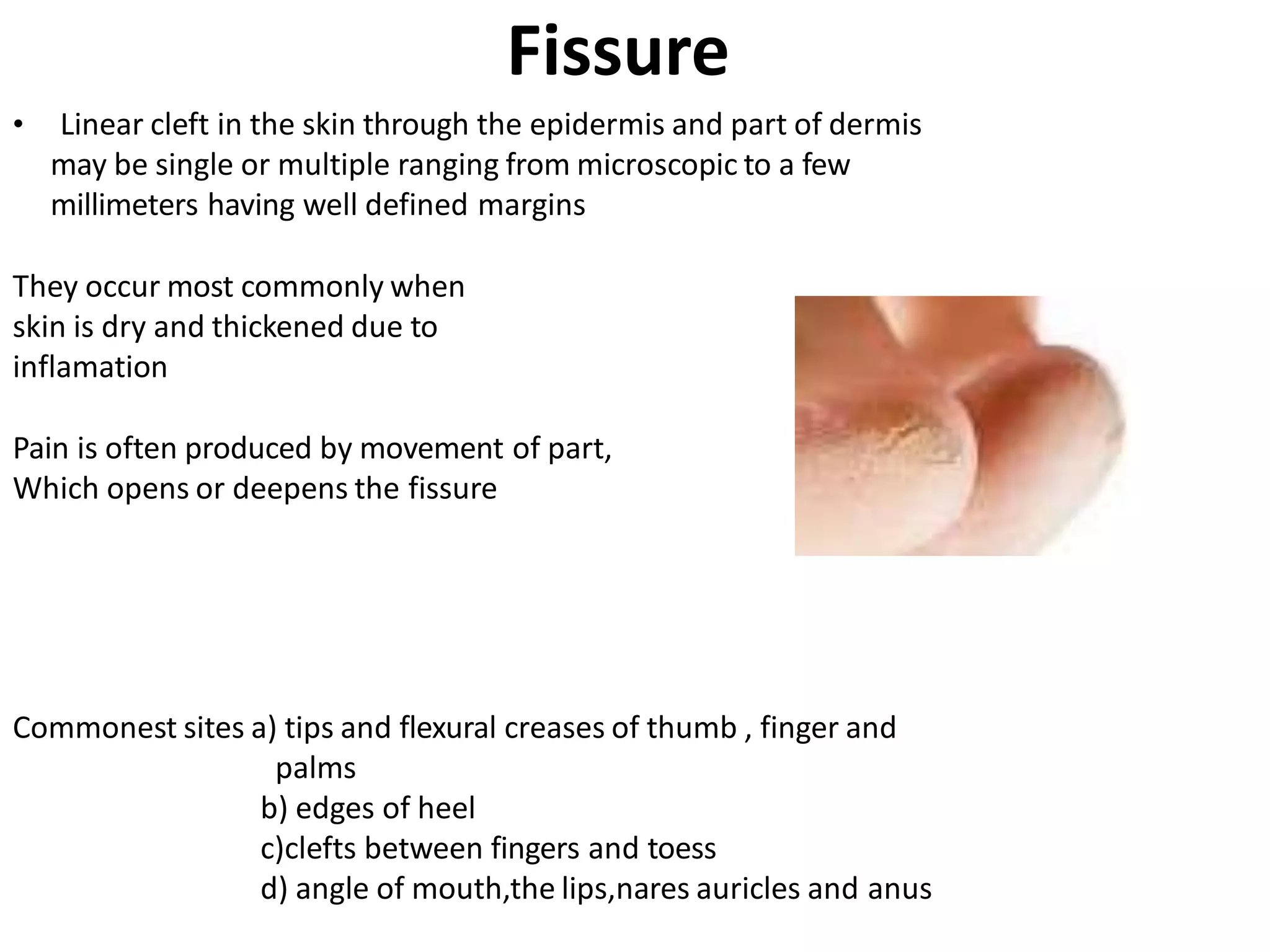 Lesions and abrasions in skin | PDF