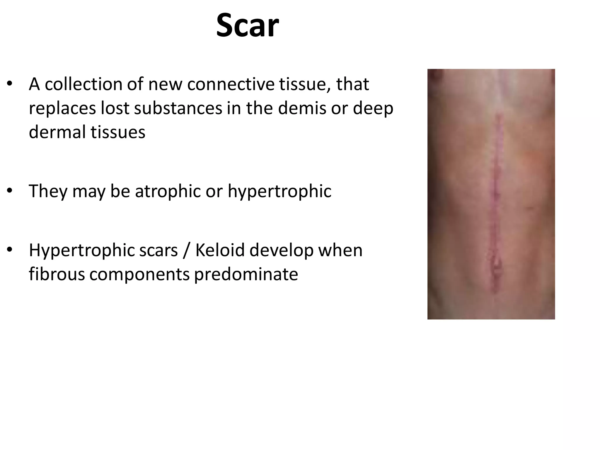 Lesions and abrasions in skin | PDF