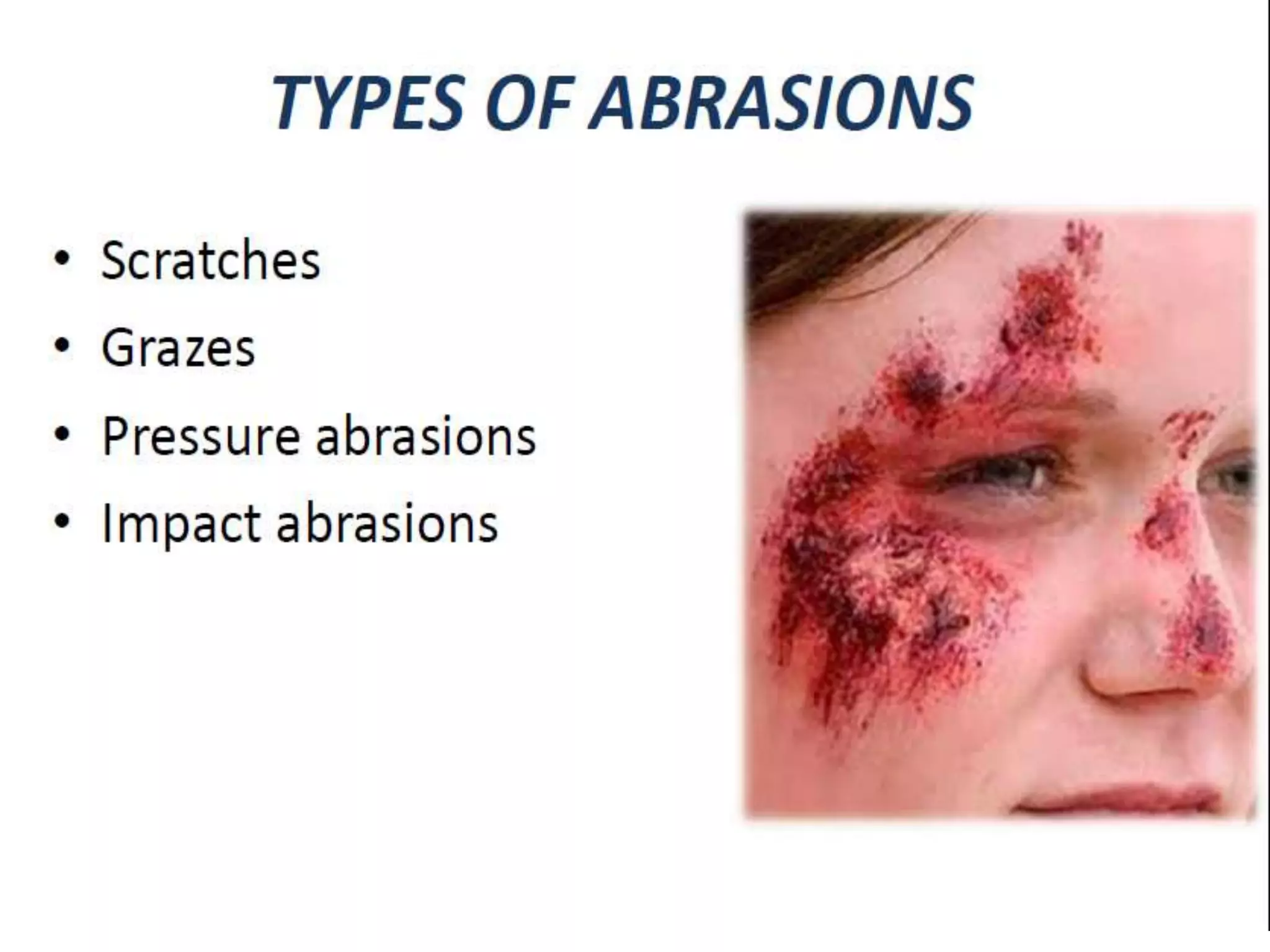 Lesions and abrasions in skin | PDF