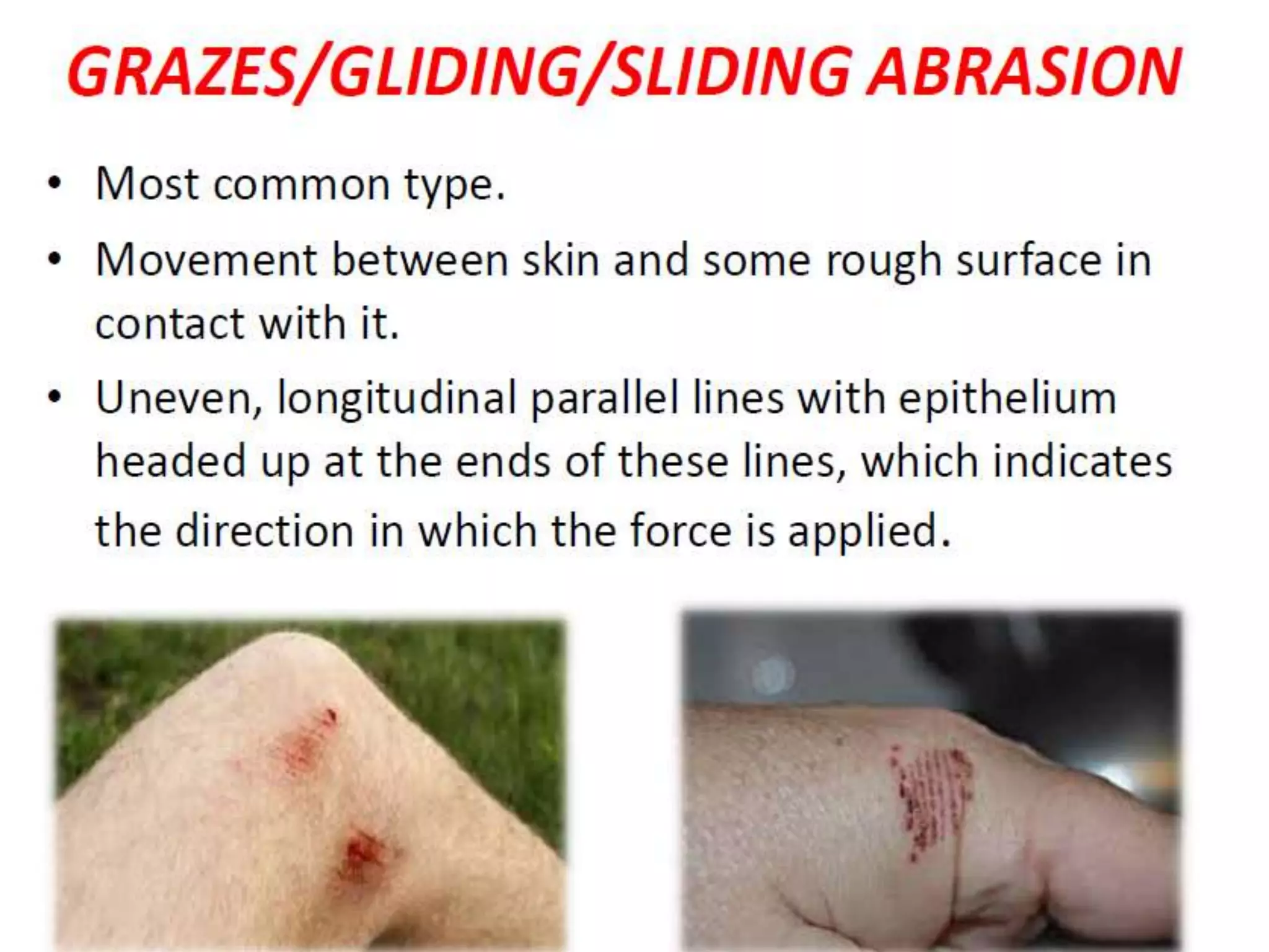 Lesions and abrasions in skin | PDF