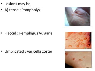 Lesions and abrasions in skin | PPT