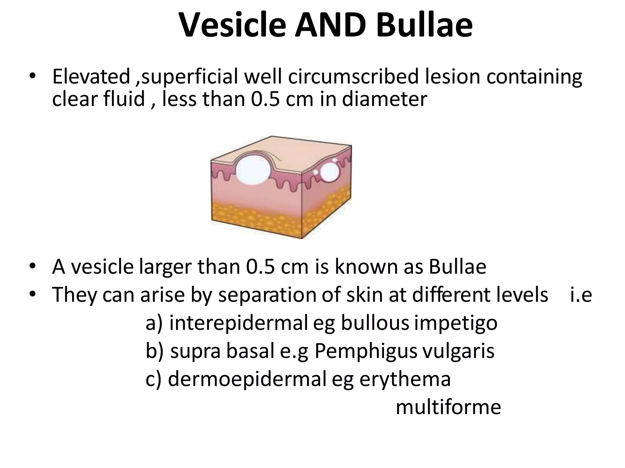 lesions and abrasions.pptx