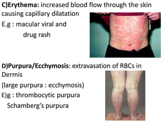lesions and abrasions.pptx