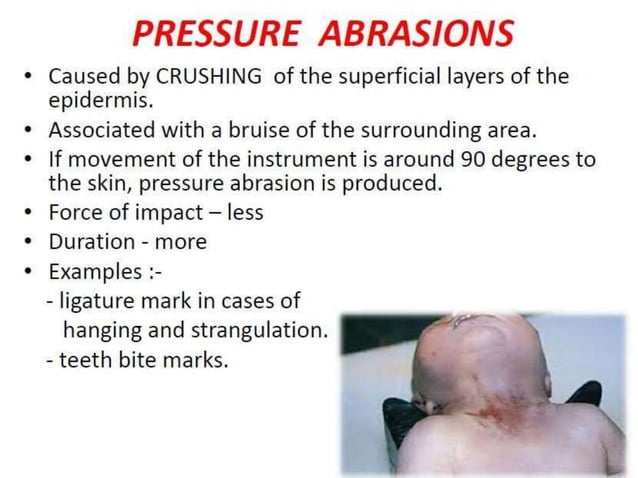 lesions and abrasions.pptx