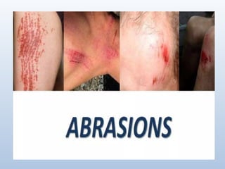 Lesions and Abrasions, Alopecia, Dermatitis and Eczema.pptx
