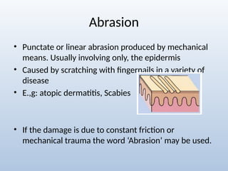 Lesions and Abrasions, Alopecia, Dermatitis and Eczema.pptx