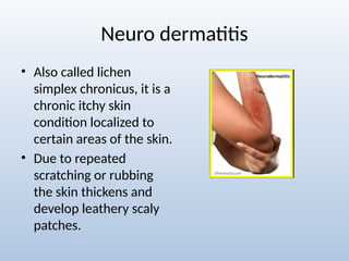 Lesions and Abrasions, Alopecia, Dermatitis and Eczema.pptx