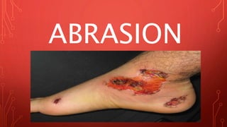 lesions and abrasions of skin.pptx