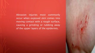 lesions and abrasions of skin.pptx