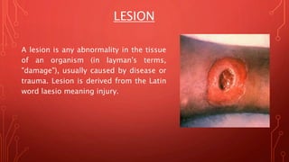 lesions and abrasions of skin.pptx