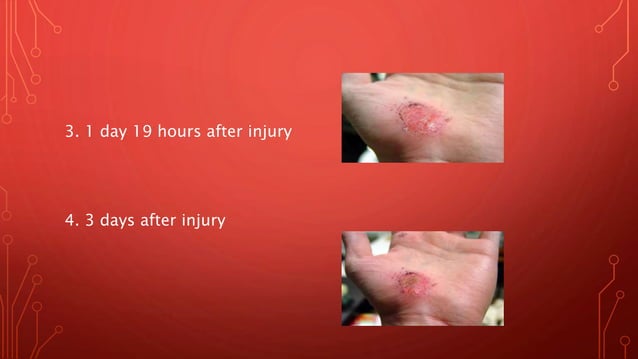 lesions and abrasions of skin.pptx