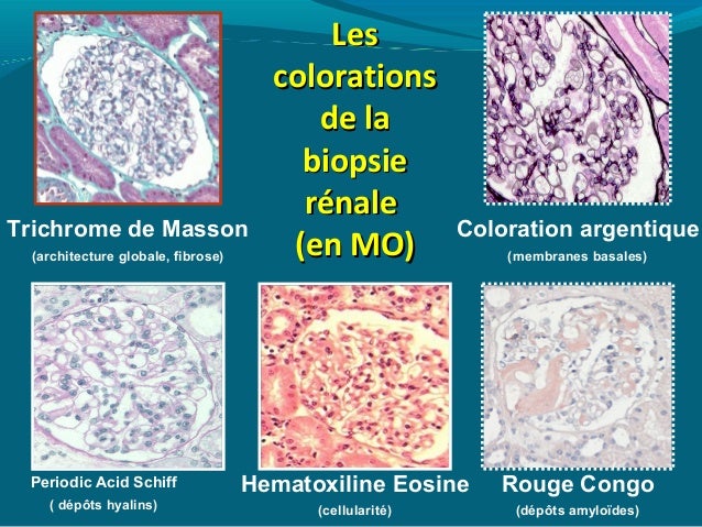 Lesions élementaires renales
