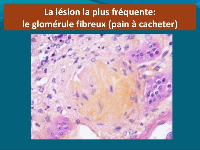 Lesions élementaires renales
