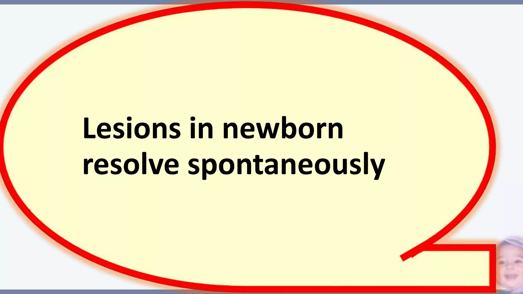 Lesions in nweborn resolve spont | PPTX