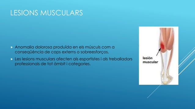 Lesions musculars fibrilar | PPT