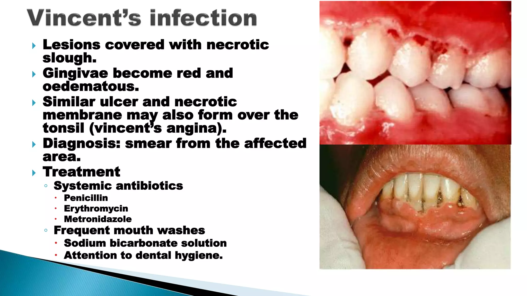 Lesions of oral cavity | PPTX