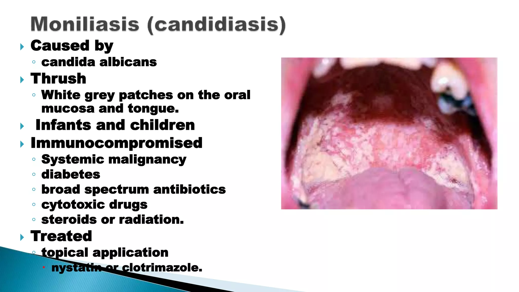 Lesions of oral cavity | PPTX