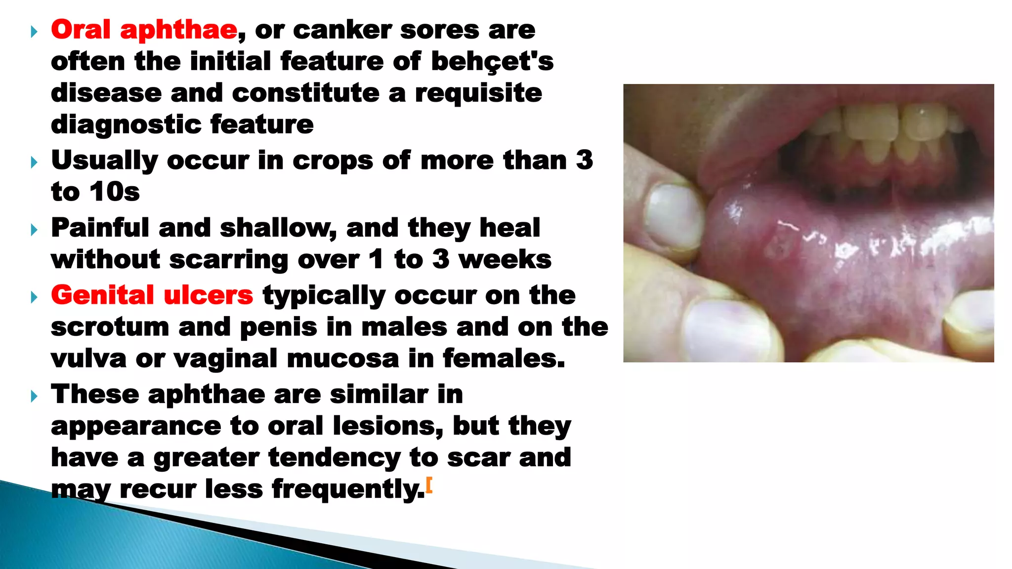 Lesions of oral cavity | PPTX