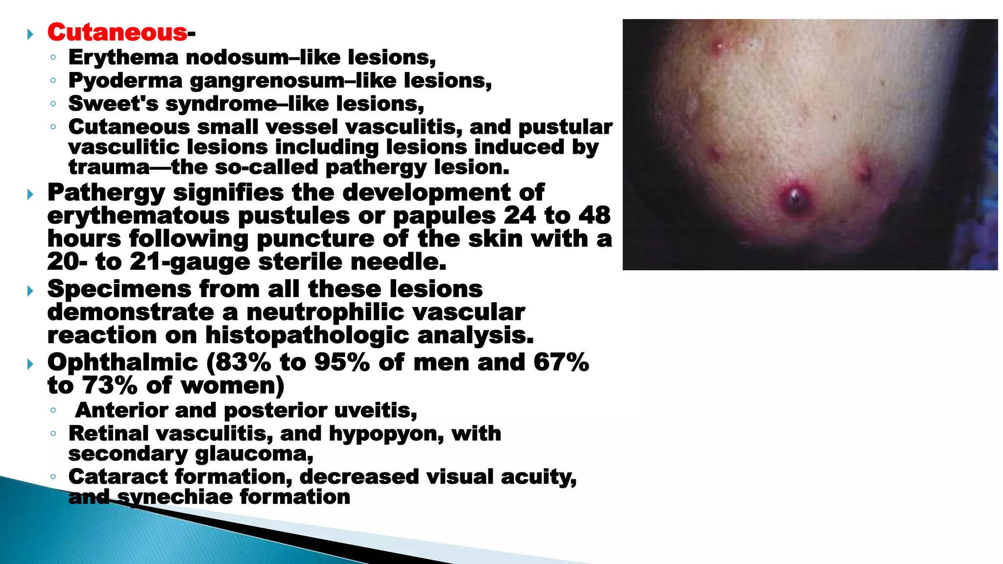 Lesions of oral cavity | PPTX