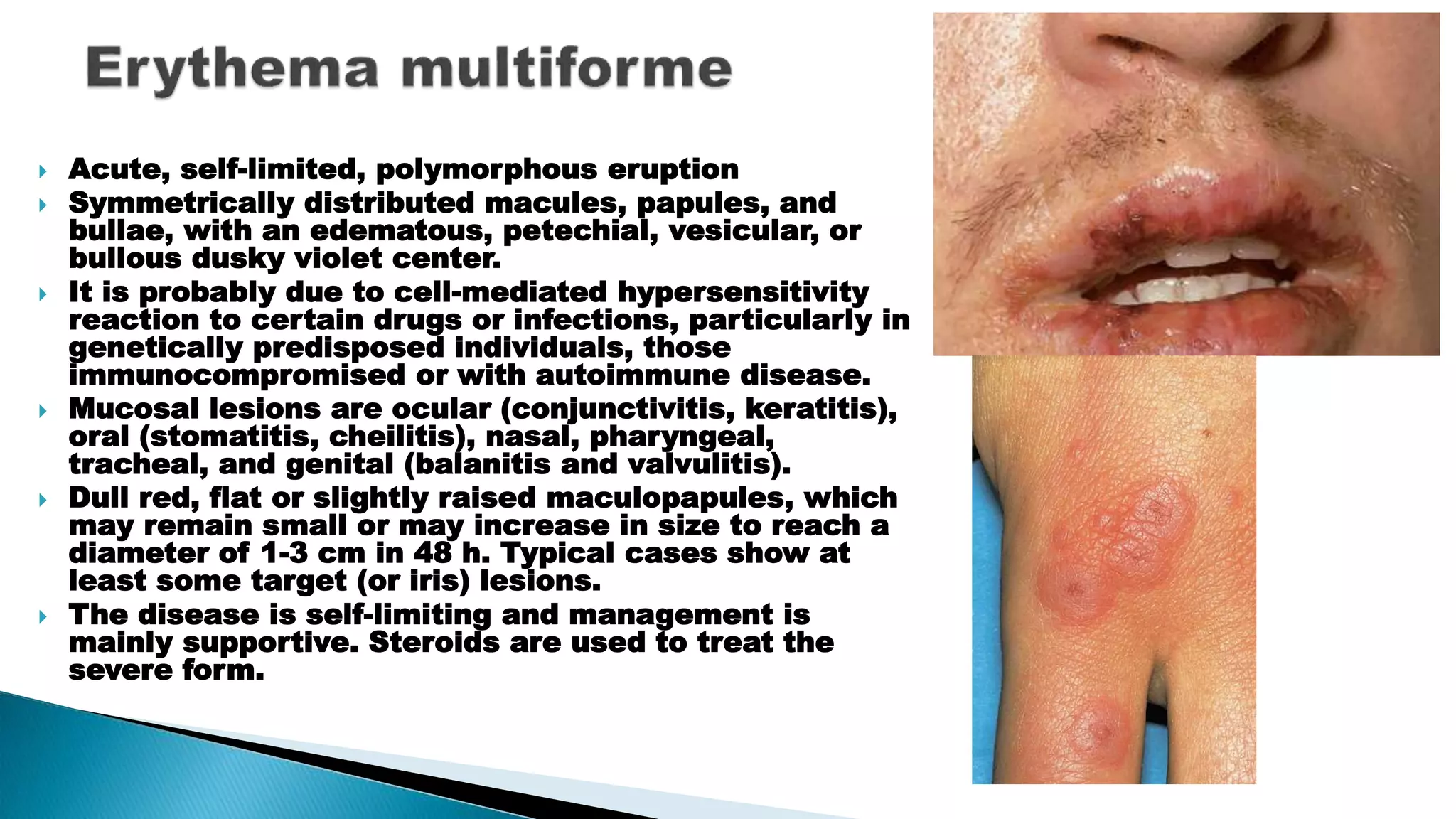 Lesions of oral cavity | PPTX