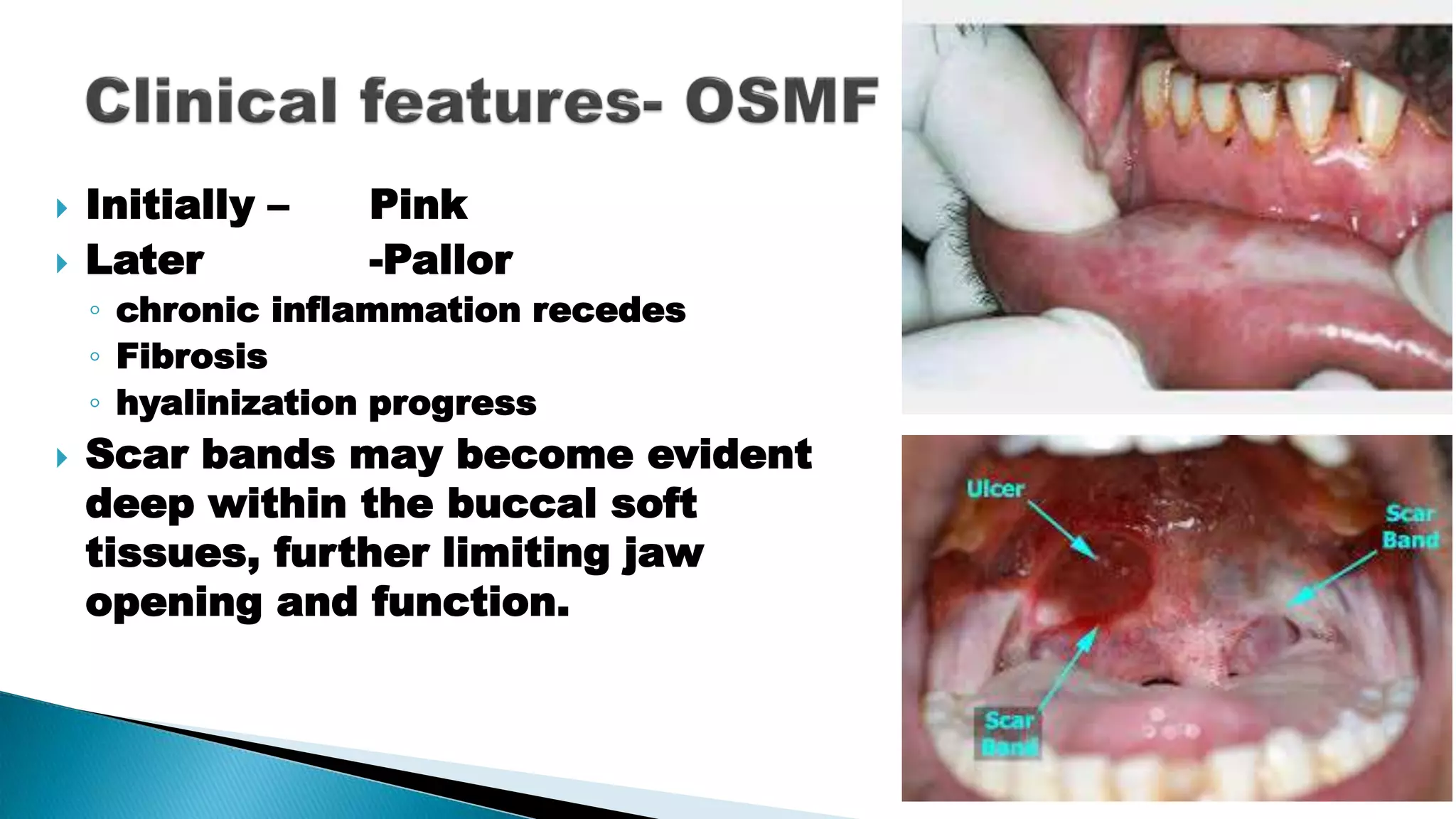 Lesions of oral cavity | PPTX