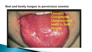 Lesions of oral cavity | PPTX