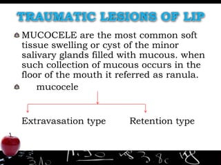 Lesions of oral mucosa in children By Dr Sachin Rathod | PPTX