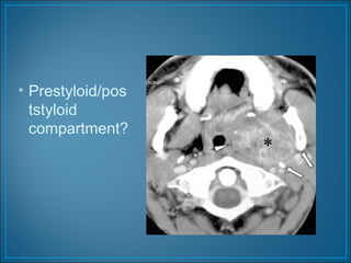 Lesions of parapharyngeal region | PPT
