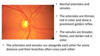 Lesions of retina | PPTX