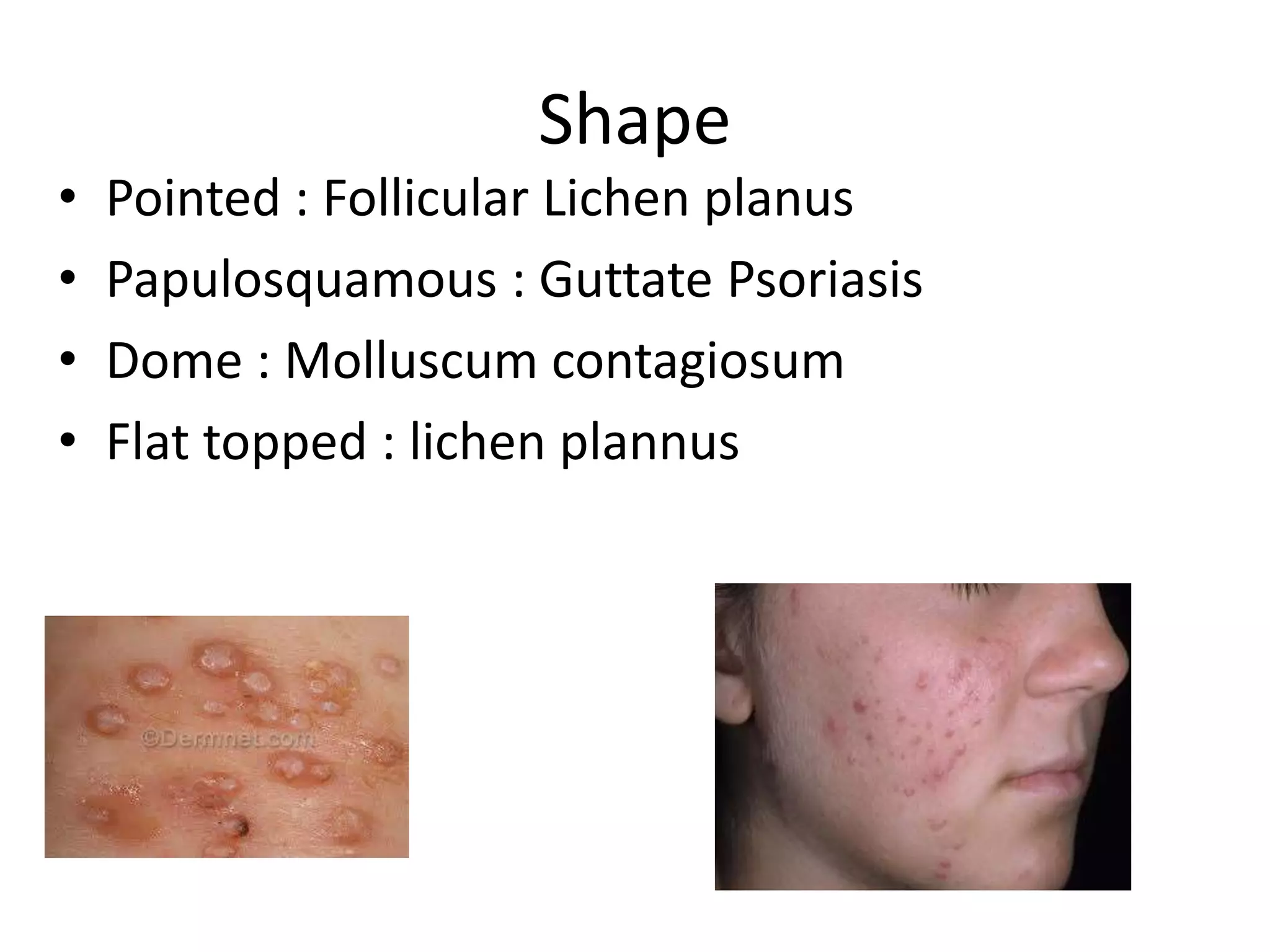 Lesions of skin | PPTX